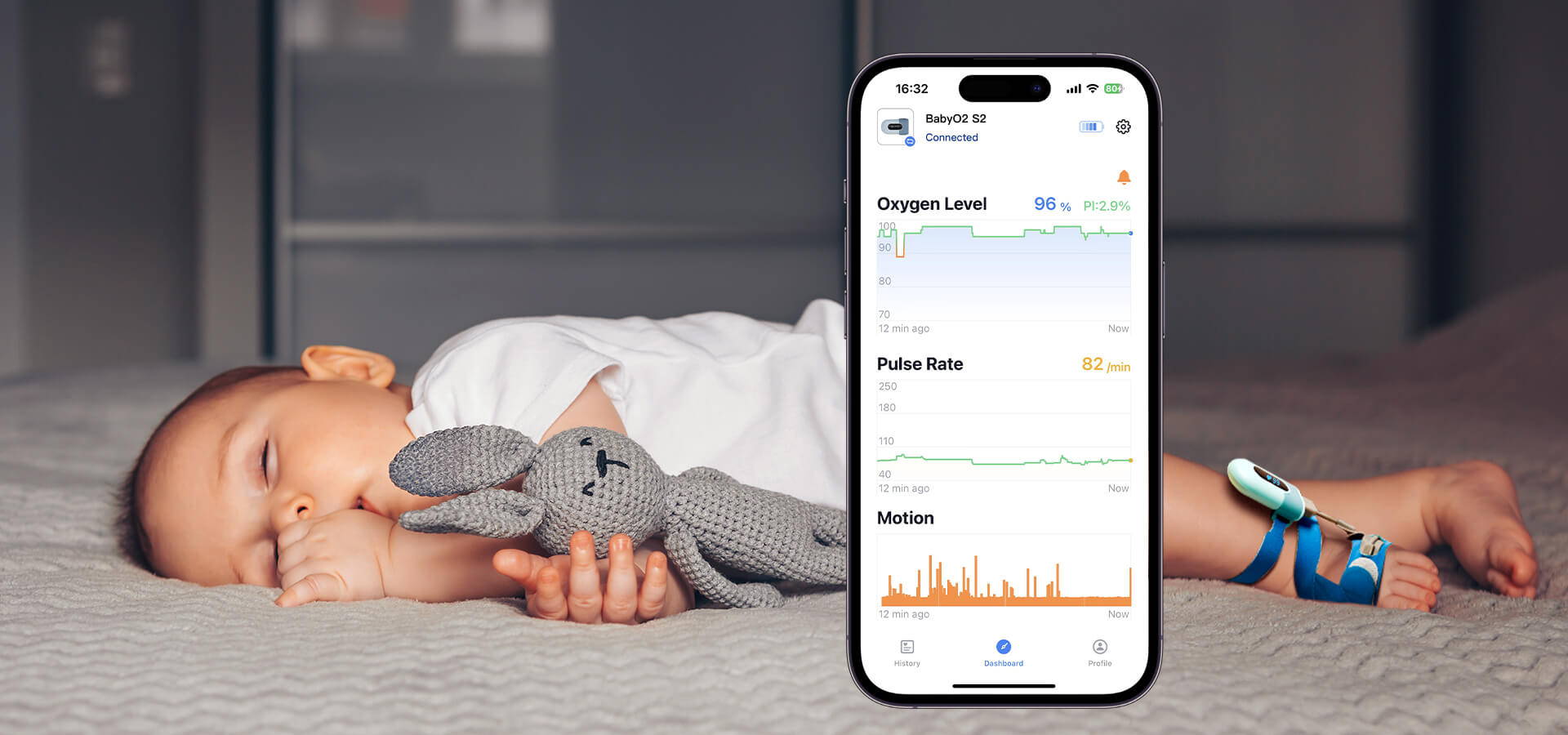 Babytone Accurate Infant Oximeter for Home Use