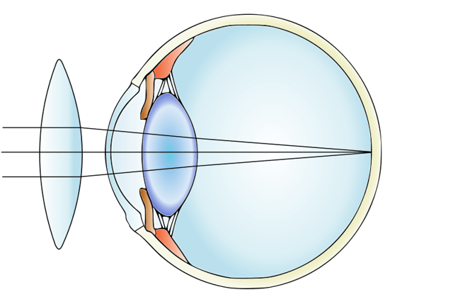 The Key Difference Between Nearsighted Vs Farsighted Vision | EyeMountain