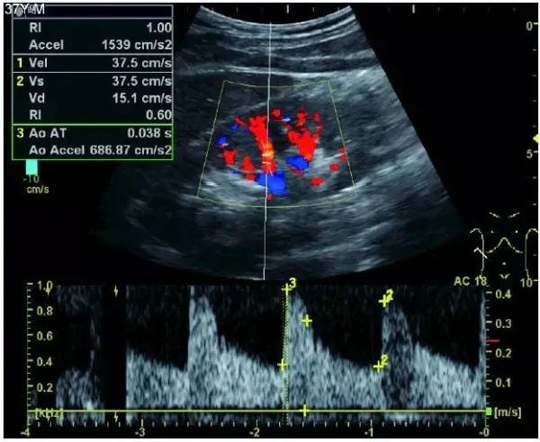 Kidney Ultrasound Images (POCUS): 4 Common Conditions and Scan Tips Us ...
