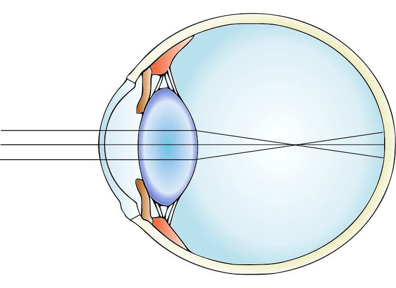 The Key Difference Between Nearsighted Vs Farsighted Vision | EyeMountain