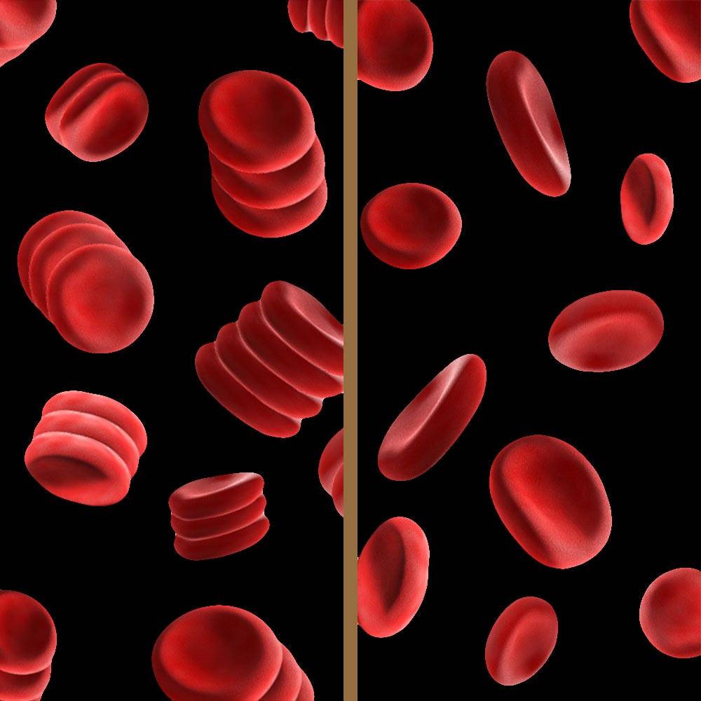 How PEMF Effects Your Blood To Improve Circulation - Pulsed Electromag ...