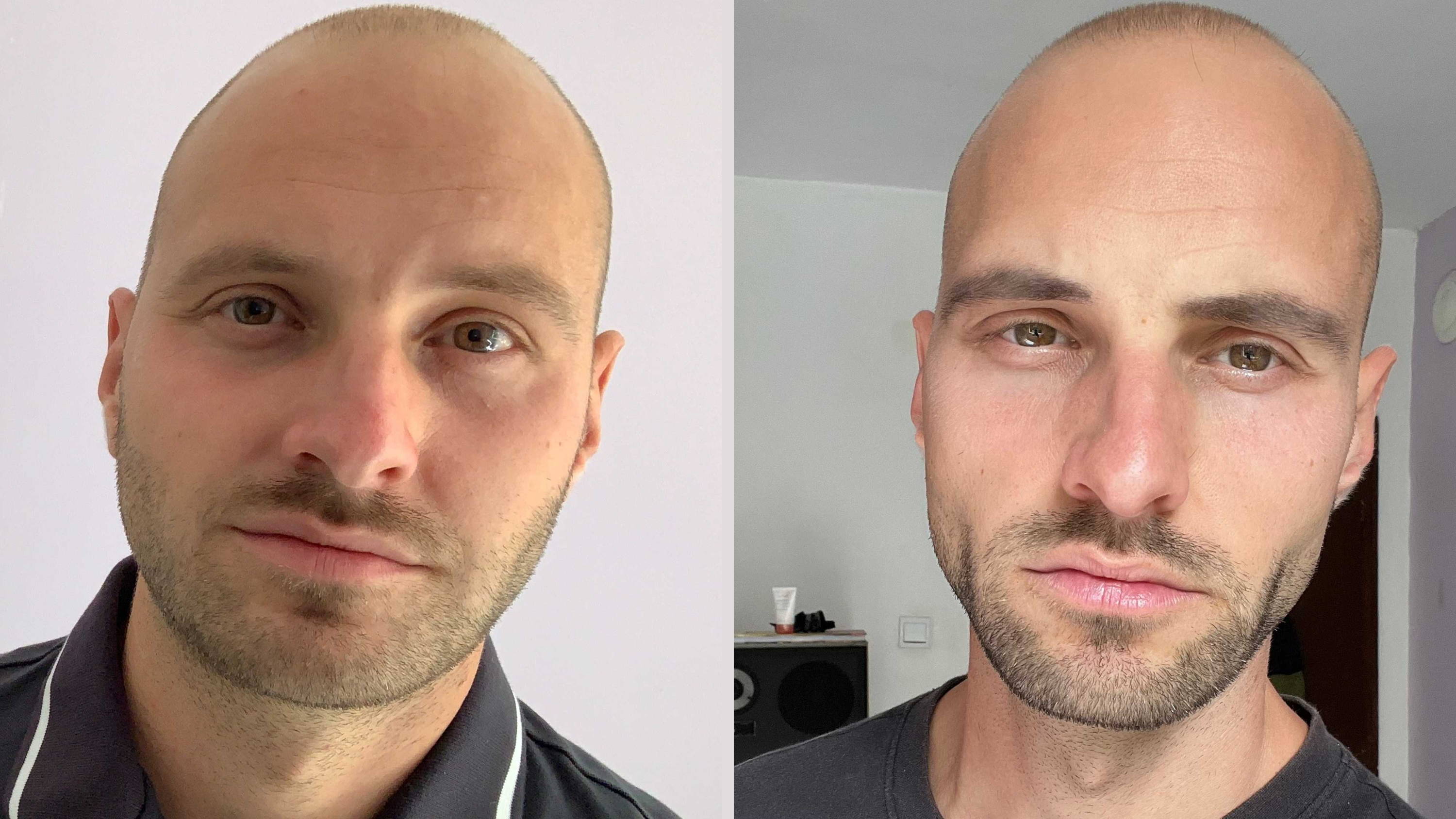 JawCuts - Jaw muscle growth technology.