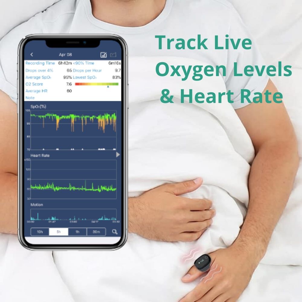 Wellue O2ring Review - Slant