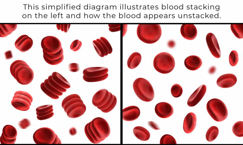How PEMF Effects Your Blood To Improve Circulation - Pulsed Electromag ...