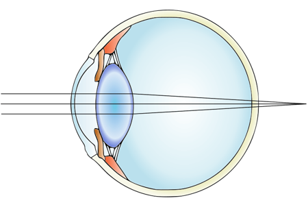 The Key Difference Between Nearsighted Vs Farsighted Vision | EyeMountain