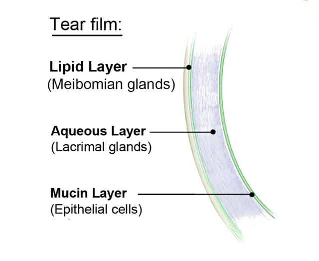 The Reason For Fluctuating Vision After Lasik | EyeMountain