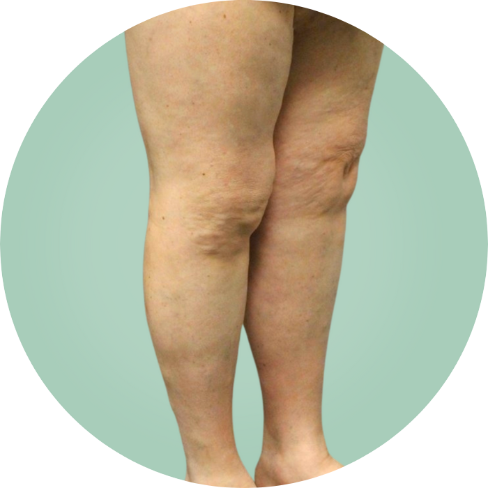 Whole-Body Massager™ (Muscle Pain Relief Device) – nooro AU