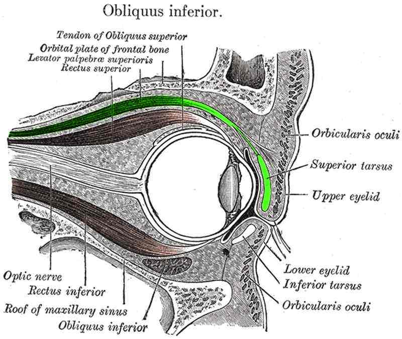 Why Do I Have A Droopy Eyelid After Cataract Surgery? | EyeMountain