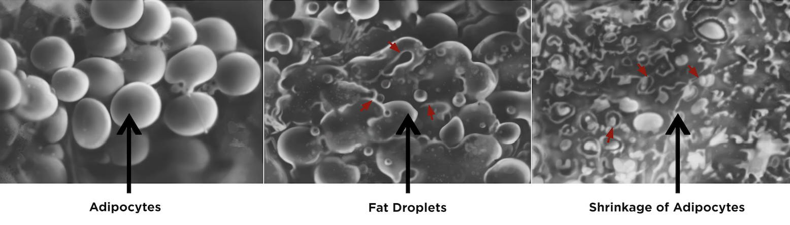 Shape Beauty | Shape and Tone your Body Naturally | Shape Beauty