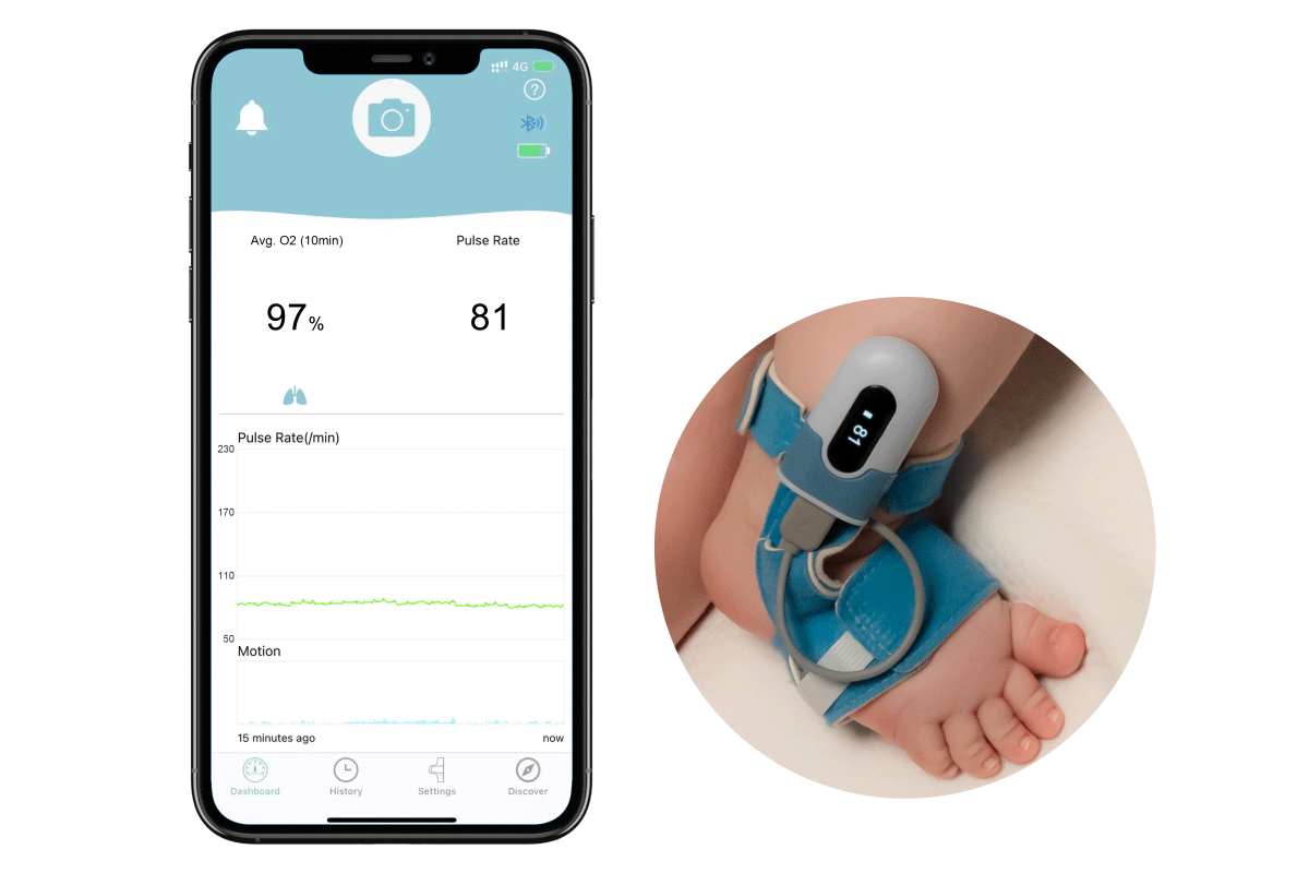 Babytone Accurate Infant Oximeter for Home Use