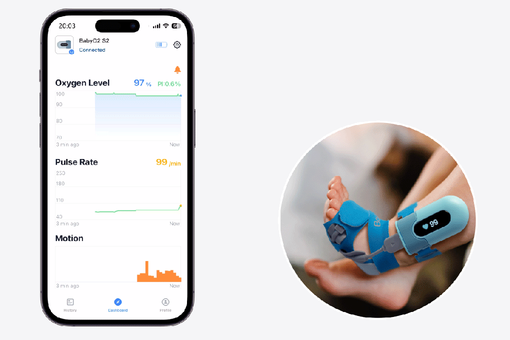 Babytone Accurate Infant Oximeter for Home Use