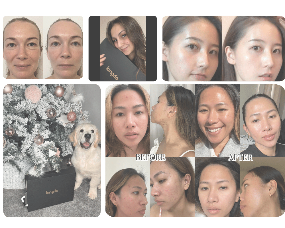 Kingdohealthy at home beauty device - Facial | Skincare | Face care