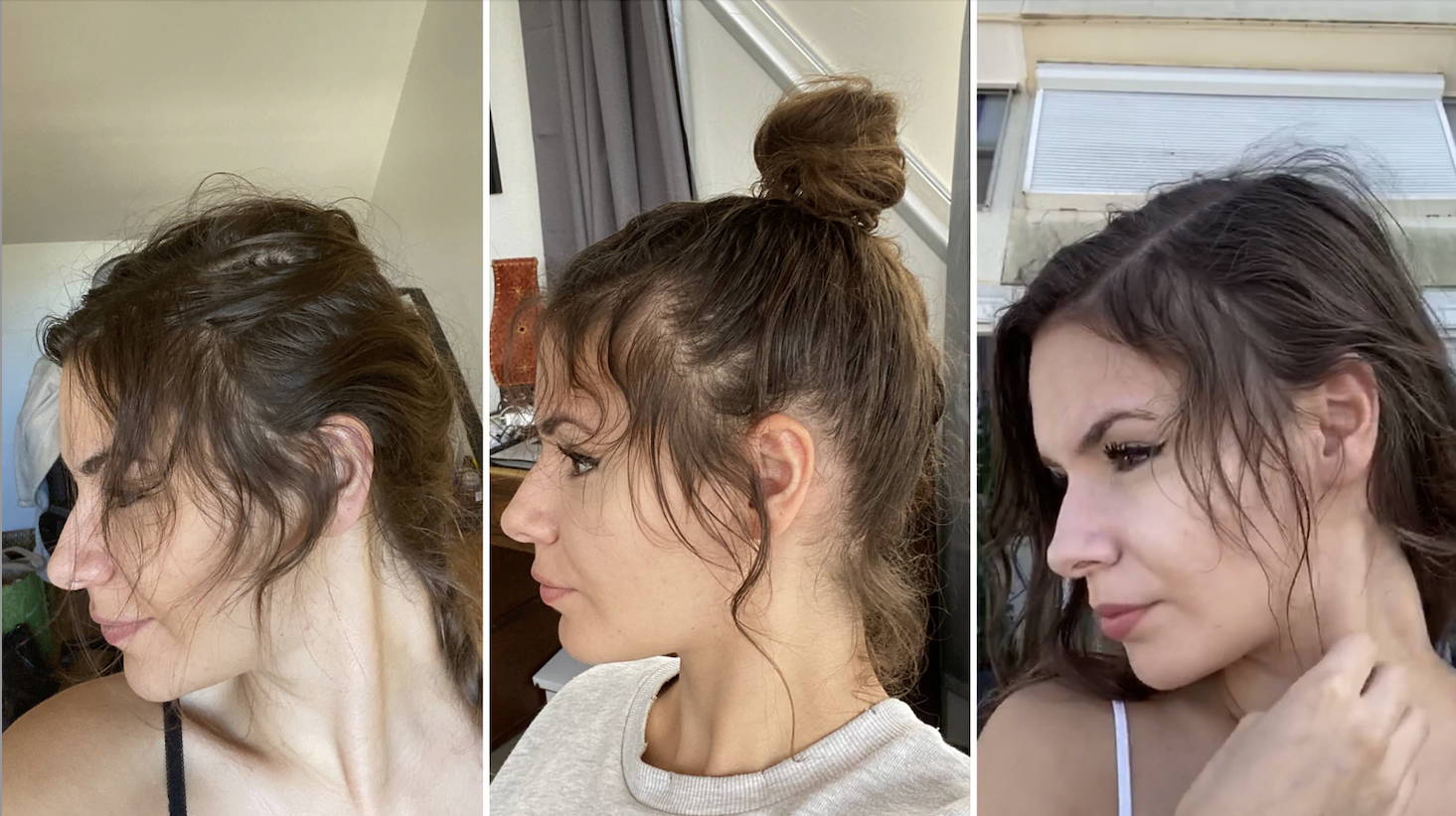 Pourquoi mes cheveux ont cassé à quelques centimètres de la racine ...