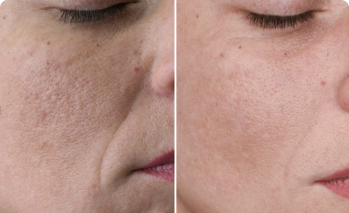 Olavita Botox Serum Olavita Skincare