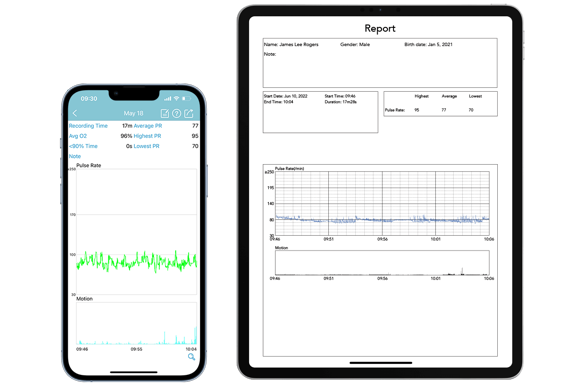 Babytone Accurate Infant Oximeter for Home Use