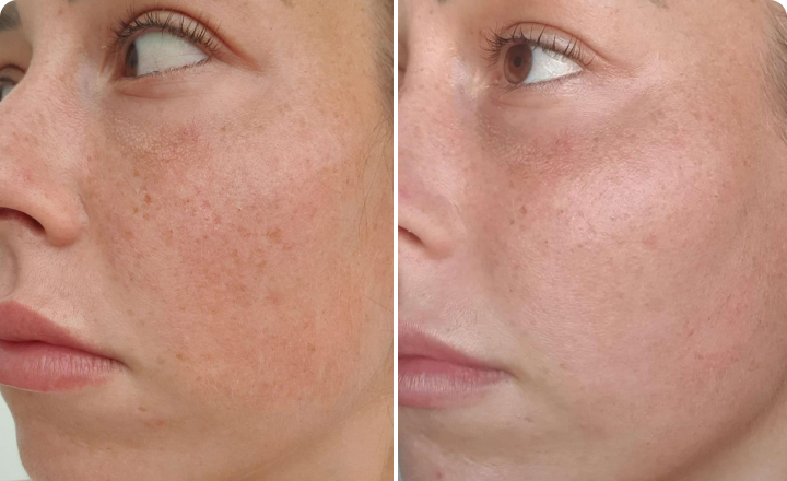 Olavita Botox Serum Olavita Skincare