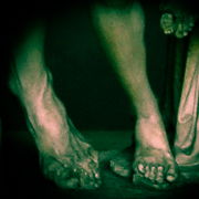 Шизофрения: роль нейрогенеза — Шаг 1 — Stepik