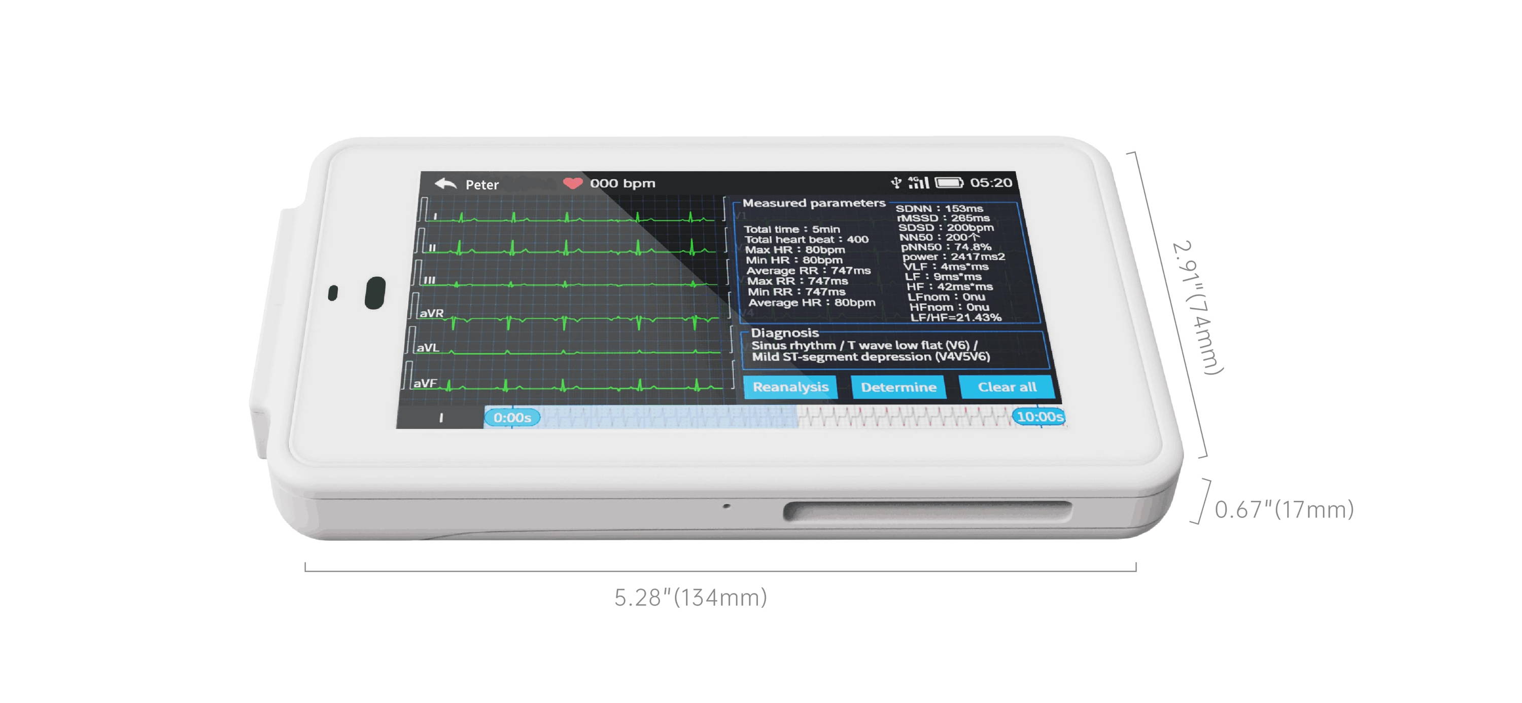 Appareil ECG portable à 12 dérivations avec interprétation qui tient ...